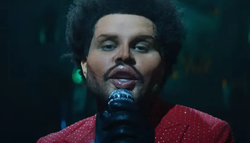 The Weekend Plastic Surgery: What Happened & Was It Real?