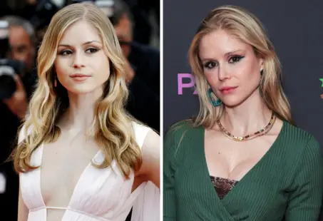 Erin Moriarty Surgery