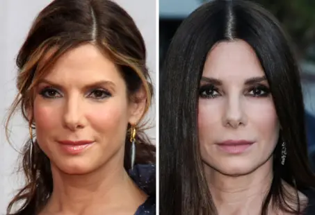 The Truth About Sandra Bullock Plastic Surgery | Longevita